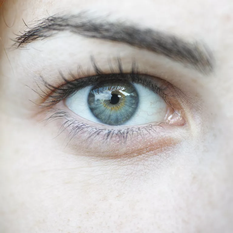 Blépharoplastie à Lyon chirurgie des paupières par le Dr Niforos